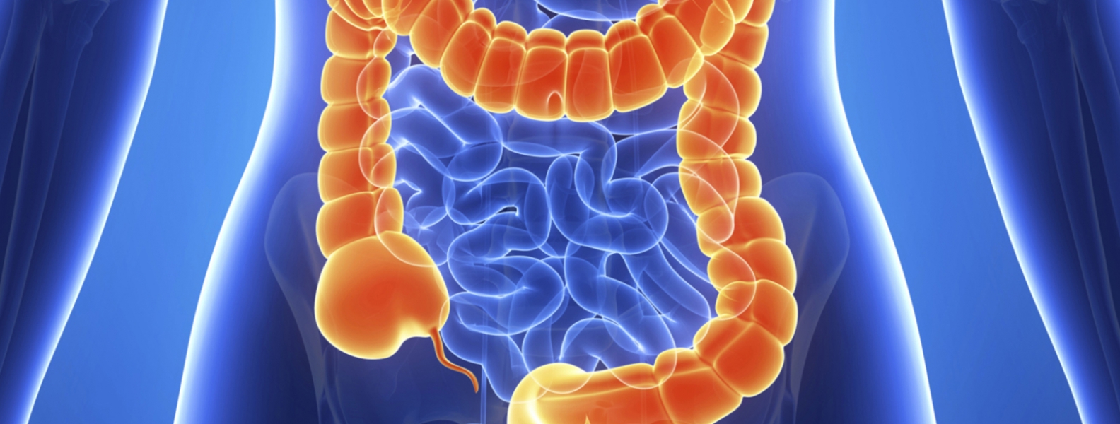 Cancerul de colon - Cardiomed Iaşi